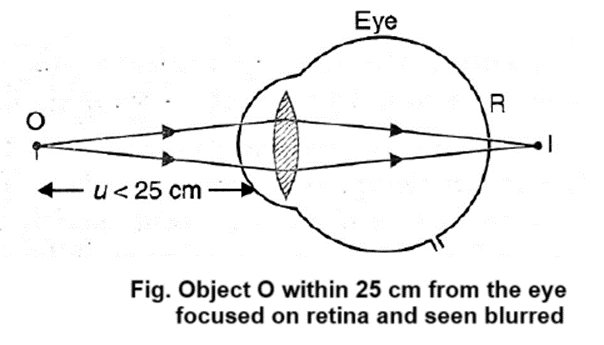 Notes-NCERT-Class-10-Science-Chapter-10-Human Eye and Colourful World ...