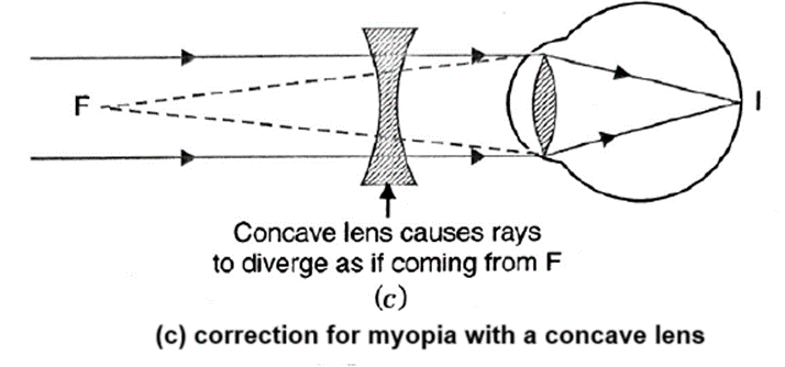 Notes-NCERT-Class-10-Science-Chapter-10-Human Eye and Colourful World ...